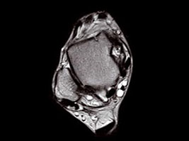 Esaote O-scan Dedicated MRI System
