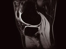 Esaote O-scan Dedicated MRI System