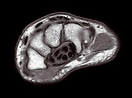 Esaote O-scan Dedicated MRI System